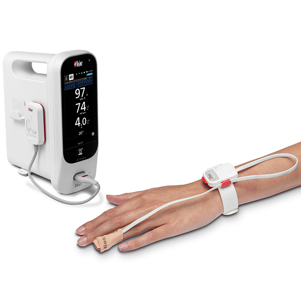 Masimo Radius PPG - Norso Medical