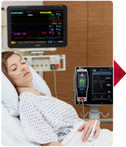 Masimo iSirona - Norso Medical